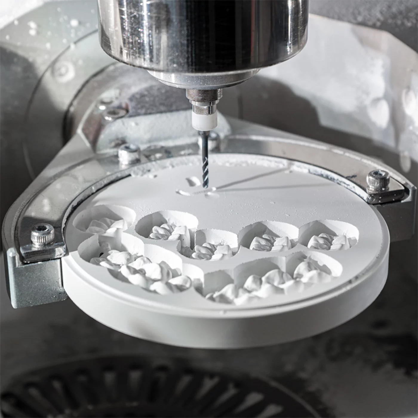 Enhancing Dental Restorations with De Corematrix Dental Ceramics - De ...